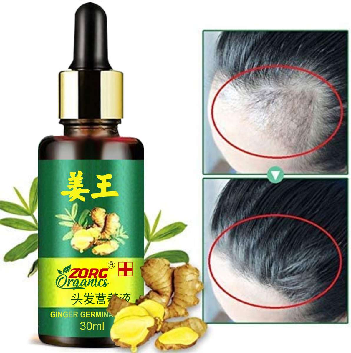 Zorg Organics Ginger Hair Oil - for Dandruff Care - All Hair Types ...