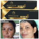 Royalstar Derma 15 Skin Specialist Cream 25g: Buy Royalstar Derma 15 ...