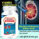 Zenius Stonil Capsule for Relife From Kidney Stone & Urinary Bladder ...