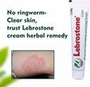 Lebrostone Ayurvedic Skin Care Treatment Cream 25g – For Ringworm ...