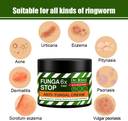 Dr.Rivo PROFESSIONAL Ayurvedic -Anti fungal Malam - for Ringworm ...