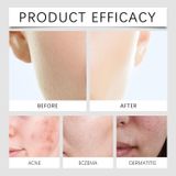 Masky 345-Relief Cream Gentle Soothing & Calming Moisturizer A180 ...