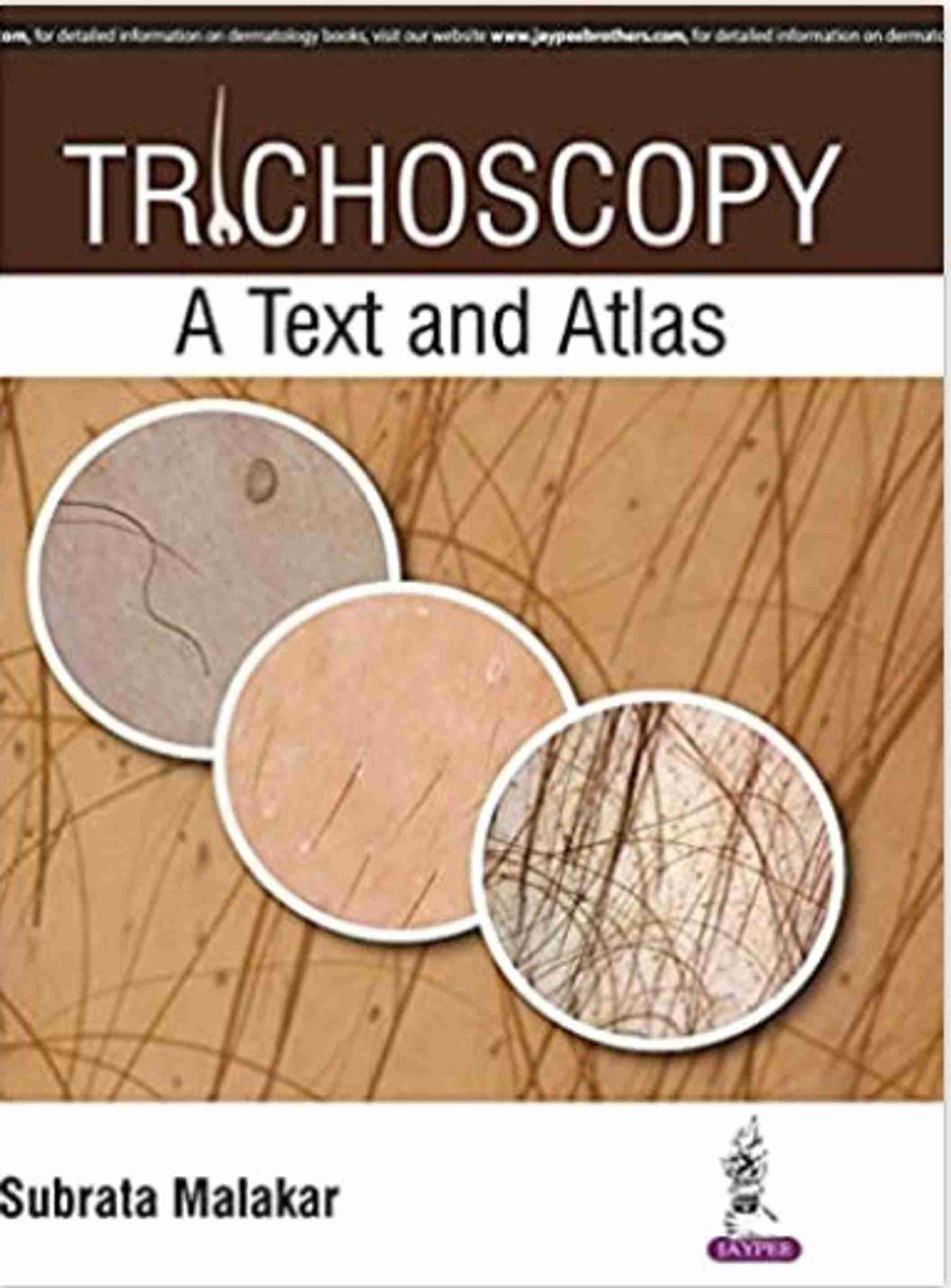 Trichoscopy: A Text Book And Atlas: A Text And Atlas: Buy Trichoscopy ...