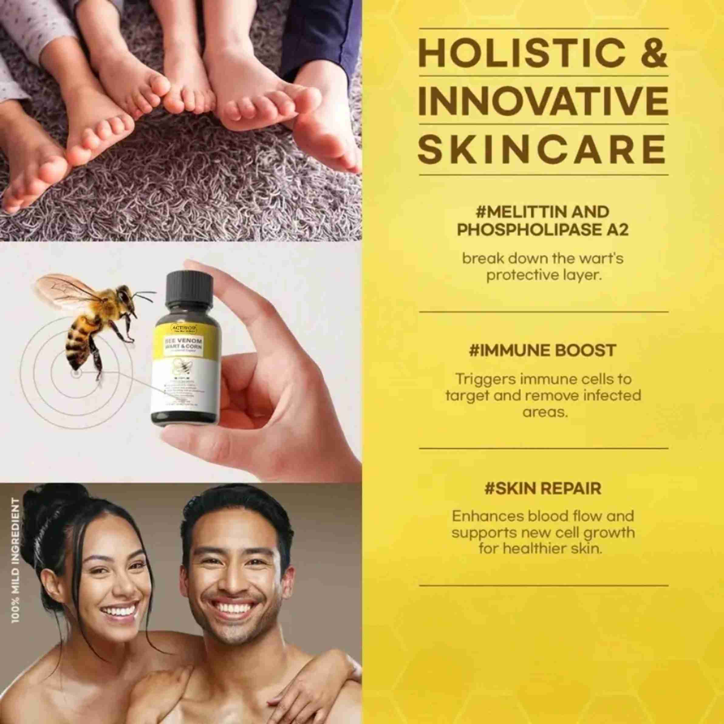 ACTIWOW Bee Venom Corn & Wart Exfoliating Peel Formula Price in India ...