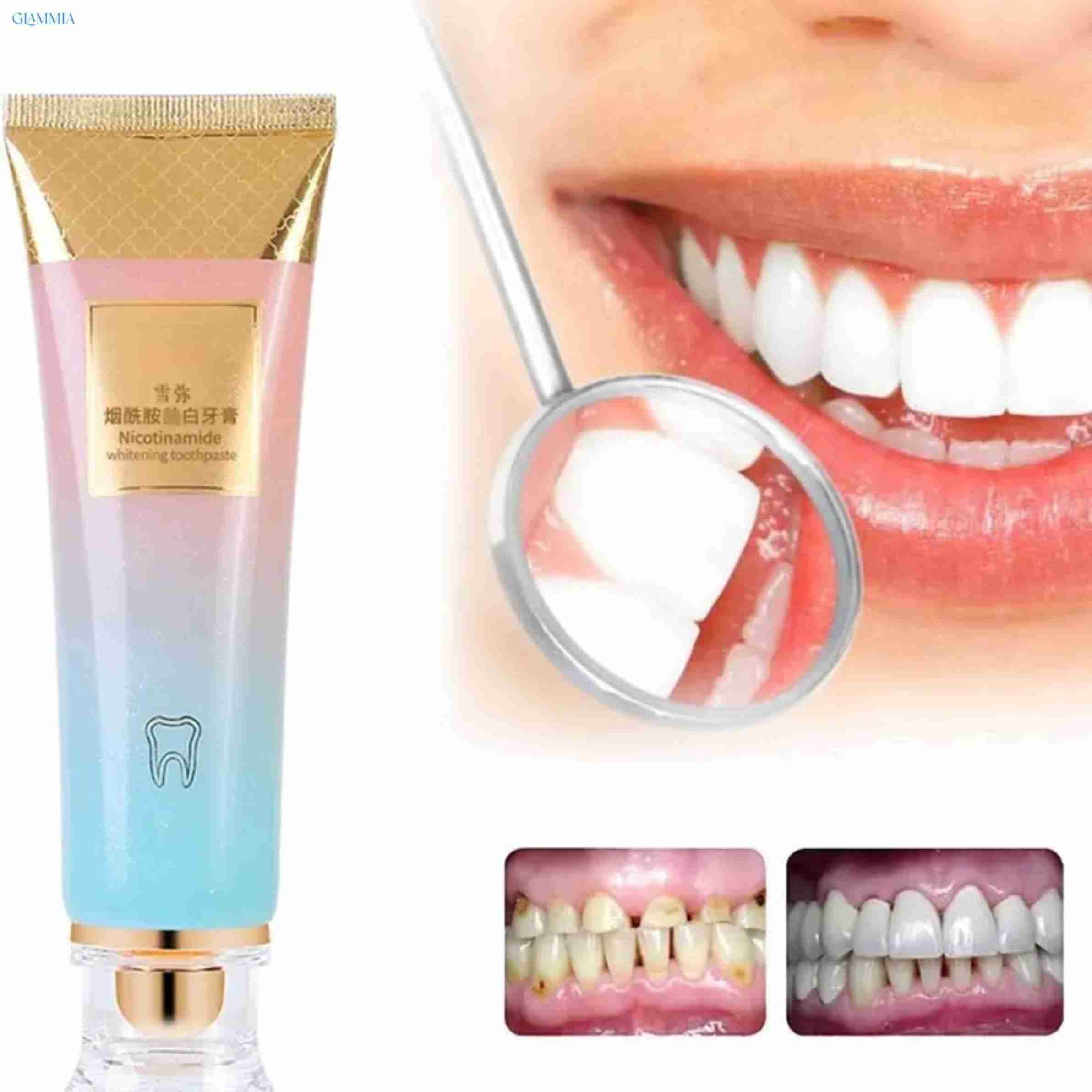 GLAMMIA Niacinamide Whitening Toothpaste Bright White | For Shiny ...