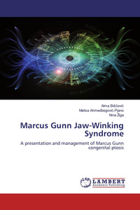 Marcus Gunn Jaw-Winking Syndrome: Buy Marcus Gunn Jaw-Winking Syndrome ...