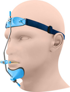 reverse pull headgear underbite