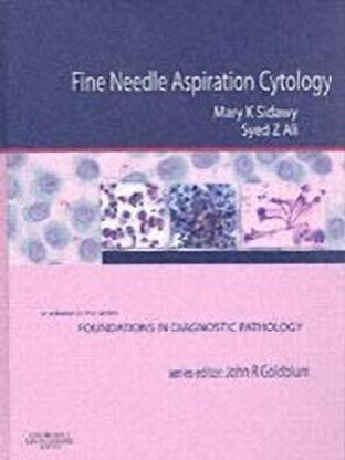 Fine Needle Aspiration Cytology: Buy Fine Needle Aspiration Cytology by ...