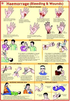 First Aid chart - Haemorrhage (Bleeding and Wounds) Photographic Paper ...
