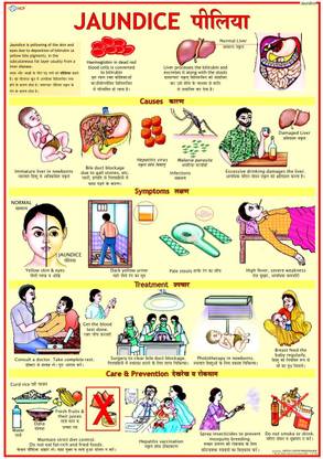 Jaundice Chart Photographic Paper - Educational posters in India - Buy ...