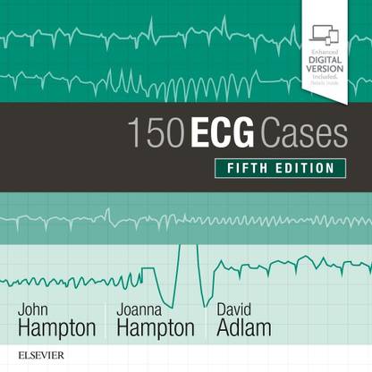 150 ECG Cases: Buy 150 ECG Cases by Hampton John DM, MA, DPhil, FRCP ...