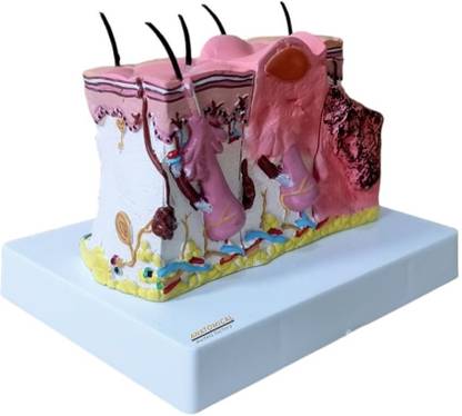 GD ANATOMICALS Human Body Anatomy Skin Burn Model Educational Tool ...