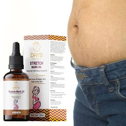 7 Days Ayurvedic Stretch Marks Scar removal oil cream Price in India ...