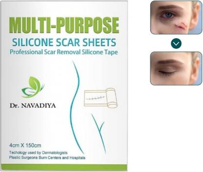 Dr. NAvadiya Scaraway Silicone Scar Sheets Flesh Color Silicone Scar ...