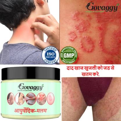 Govaggy Ayurvedic ointment malam cream for fungle infection & scar ...