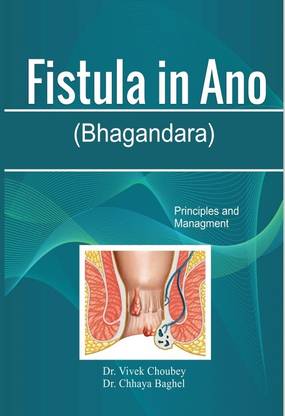 FISTULA IN ANO (BHAGANDARA) Principles and Management: Buy FISTULA IN ...