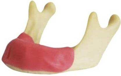 NMD DENTAL TOOL Implant Practice Mandible With Gingiva Model Surgical ...