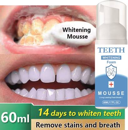 Qwera Deeply Clean Gums and Cavity Protection Teeth Whitening Foam ...