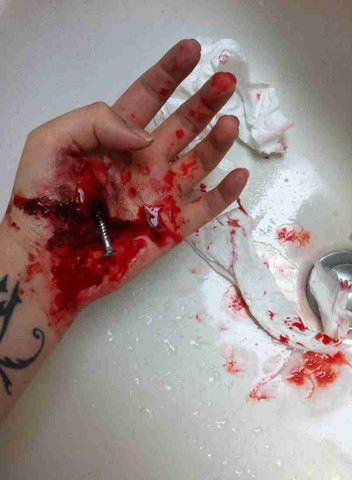 hand bleeding prank
