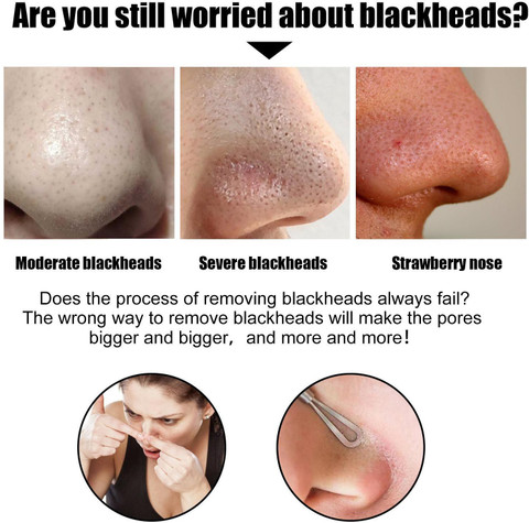 nose side black remove