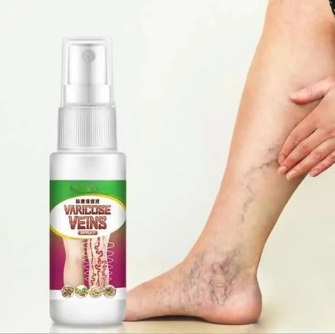 CHIWA Varicose Vein Spray For Leg Swelling & Cramp Relief Quick Comfort ...