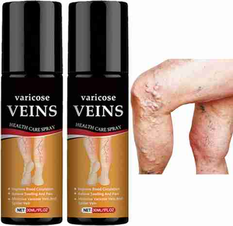 ODDEVEN Varicose Vein Leg Spray – Pain & Swelling Relief Herbal Formula ...