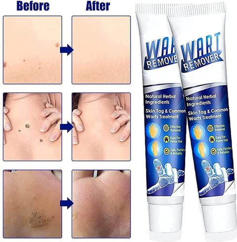 how to remove corn from face