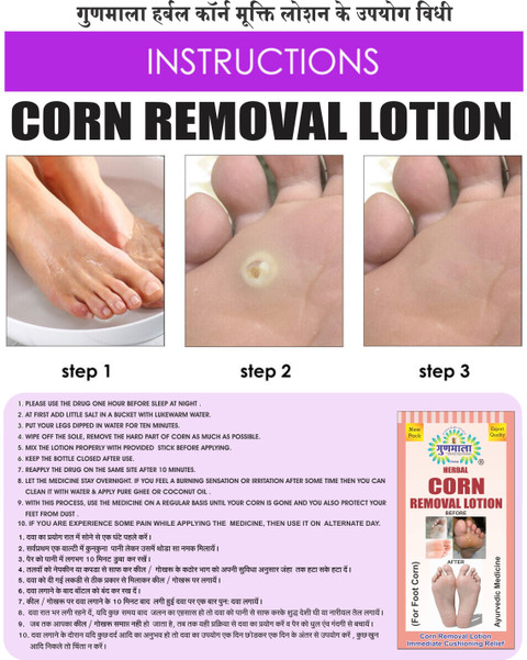 how to remove corn from face
