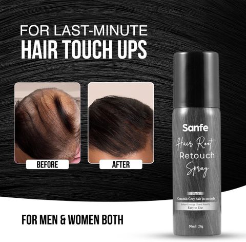Sanfe Hair Root Retouch Up Spray | Instant Grey Coverage Hair Color for ...