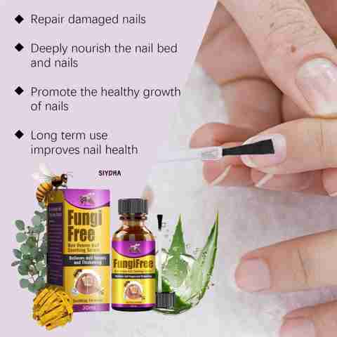 SIYDHA Fungi Free Hydrating Nail Serum For Dry And Damaged Nails ...