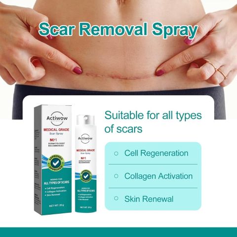 ACTIWOW Medical Grade Spray with Proven Scar Reducing Formula Price in ...