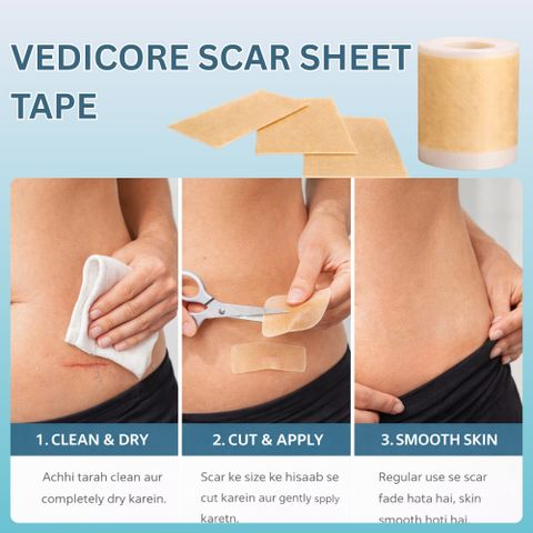 Vedicore Reusable Silicone Scar Sheets Roll for Post-Surgery, C-Section ...