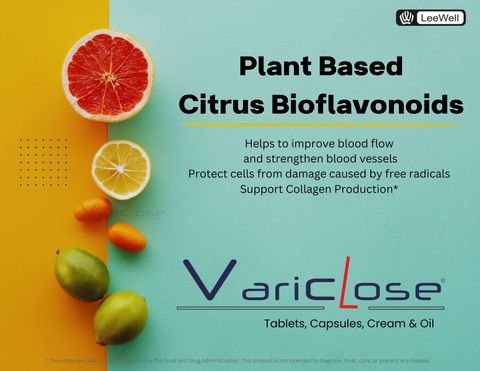 variclose Blood Vessels Poor Circulations, Varicose Veins, Piles ...
