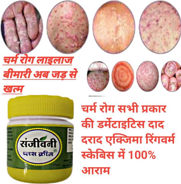 Antifungal Cream - Buy Antifungal Cream online at Best Prices in India ...