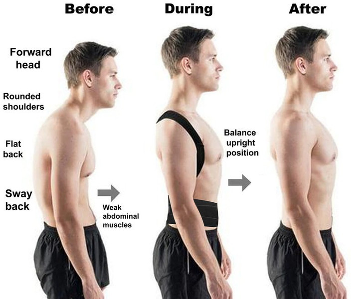flat back posture weak muscles