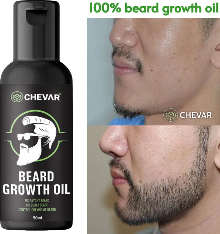 curly beard solution