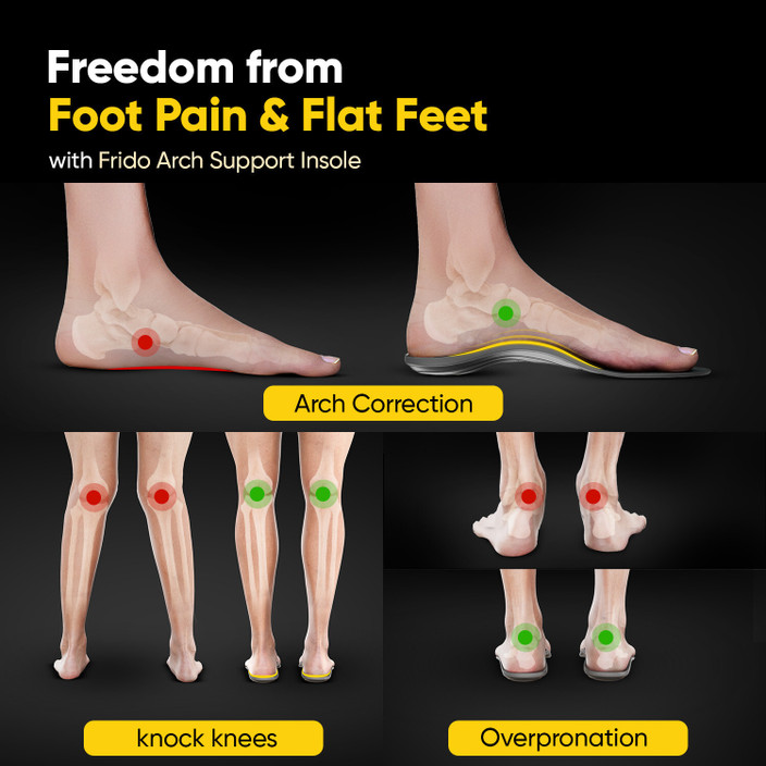 arch support exercises