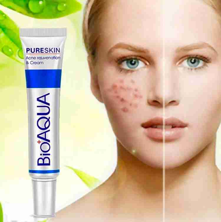 BIOAQUA Best Pimple Remover Rejuvenation Cream Price in India Buy BIOAQUA Best Pimple Remover Rejuvenation Cream online at Flipkart