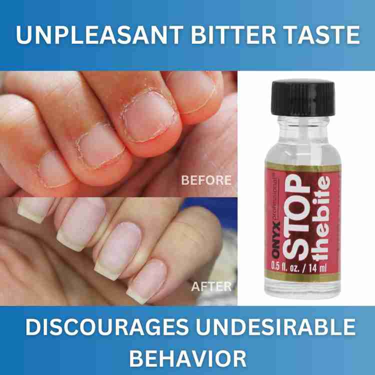 Nail biting treatment store