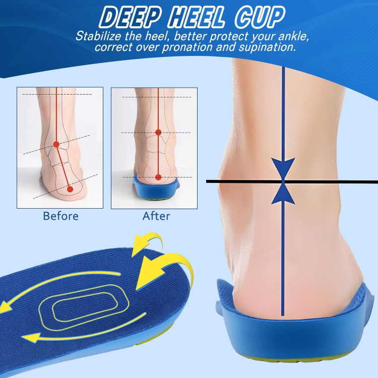 supination uk
