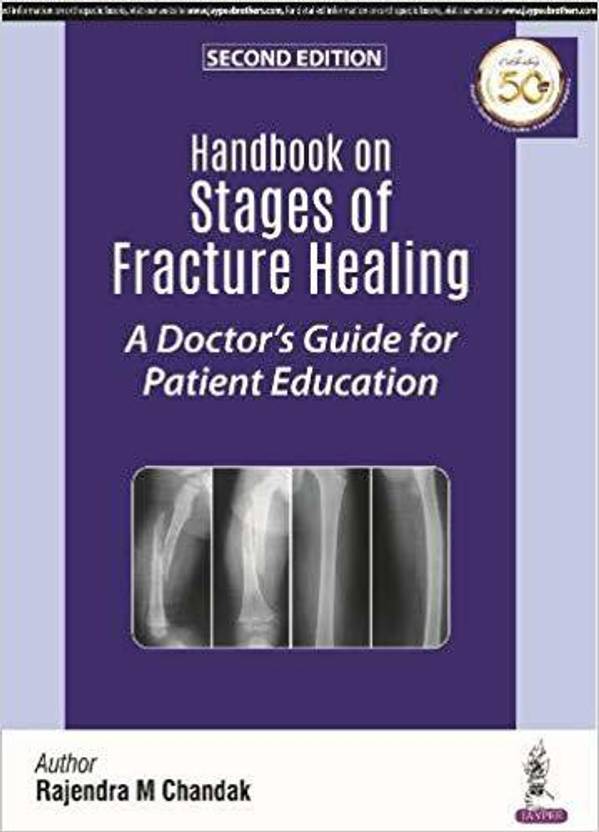 Handbook on Stages of Fracture Healing: Buy Handbook on Stages of ...