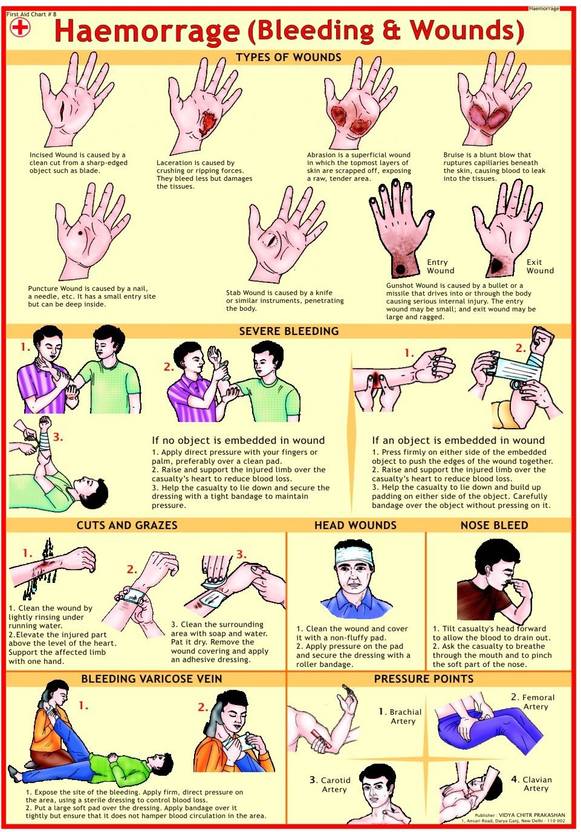 First Aid chart - Haemorrhage (Bleeding and Wounds) Photographic Paper ...