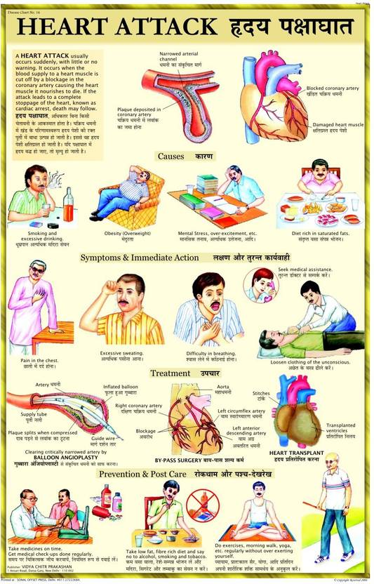 Heart Attack Chart Photographic Paper - Educational posters in India ...