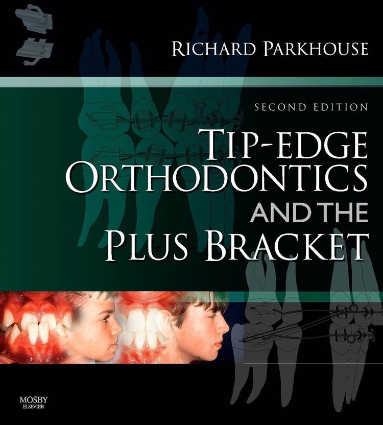 Tip-Edge Orthodontics and the Plus Bracket: Buy Tip-Edge Orthodontics ...