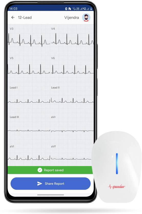 Sunfox Technologies Spandan 4.0 Portable ECG Device Electrotherapy ...