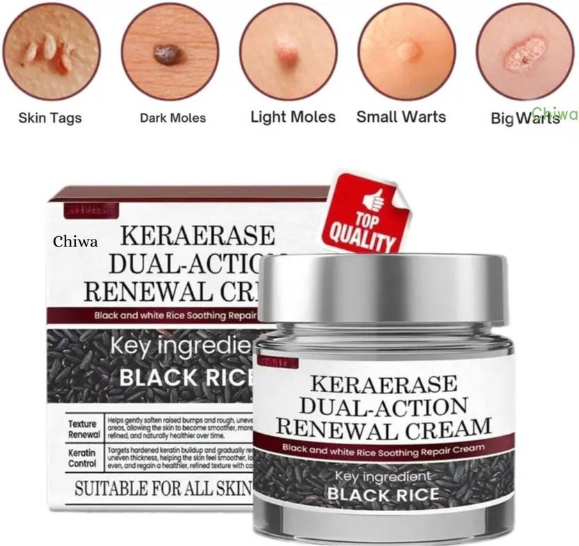 CHIWA Keraerase Dual Action Renewal Cream | For Soft Tone Restoration ...