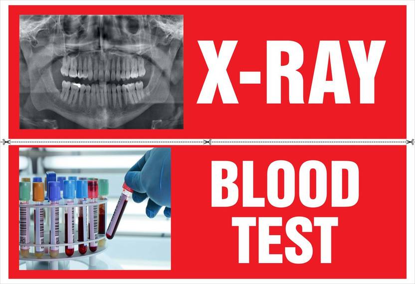 Poster Doctor Medical X Ray & Blood Test Sticker sl-9677 (Wall Poster ...