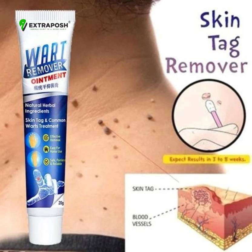Extraposh Warts of Instant Blemish Removal Cream, Wart Remover Ointment ...