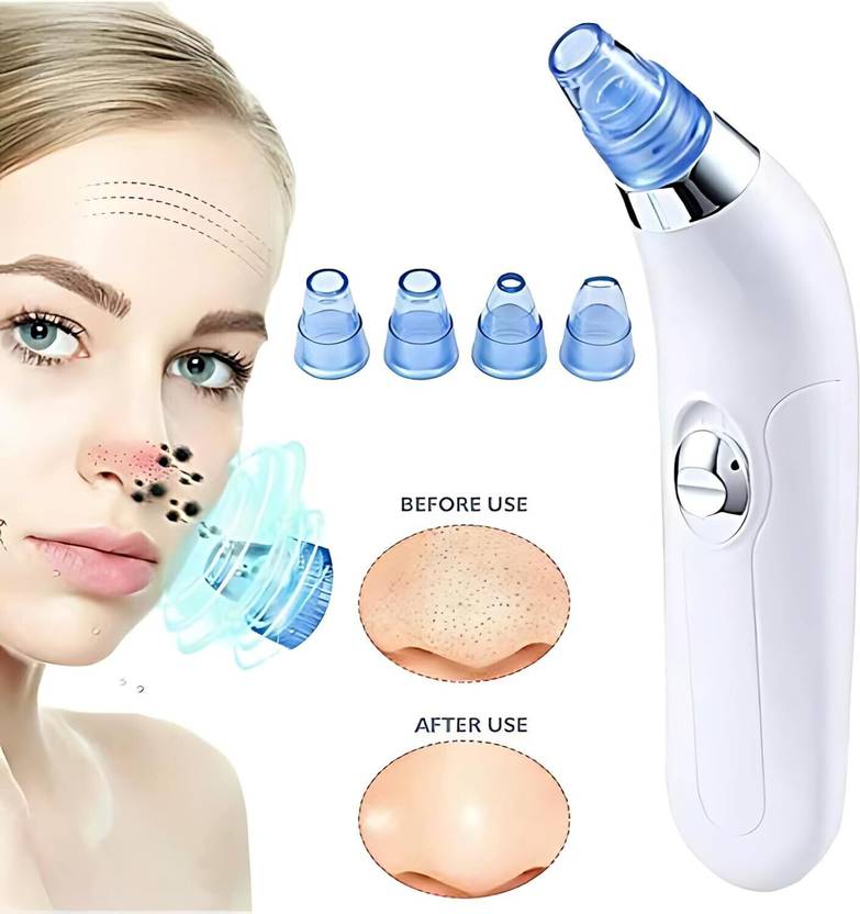 Kapmore Blackhead Remover Vacuum Device for Deep Pore Cleansing ...