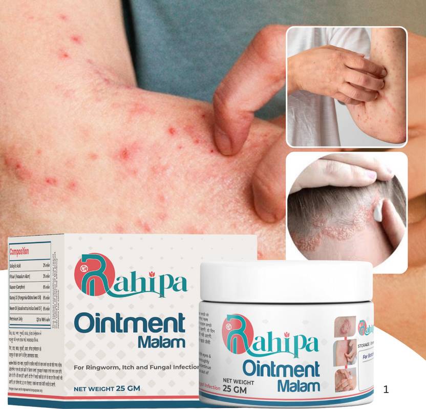 RAHIPA Ayurvedic Malam for Fungal Infection, Itching & Skin Rash ...